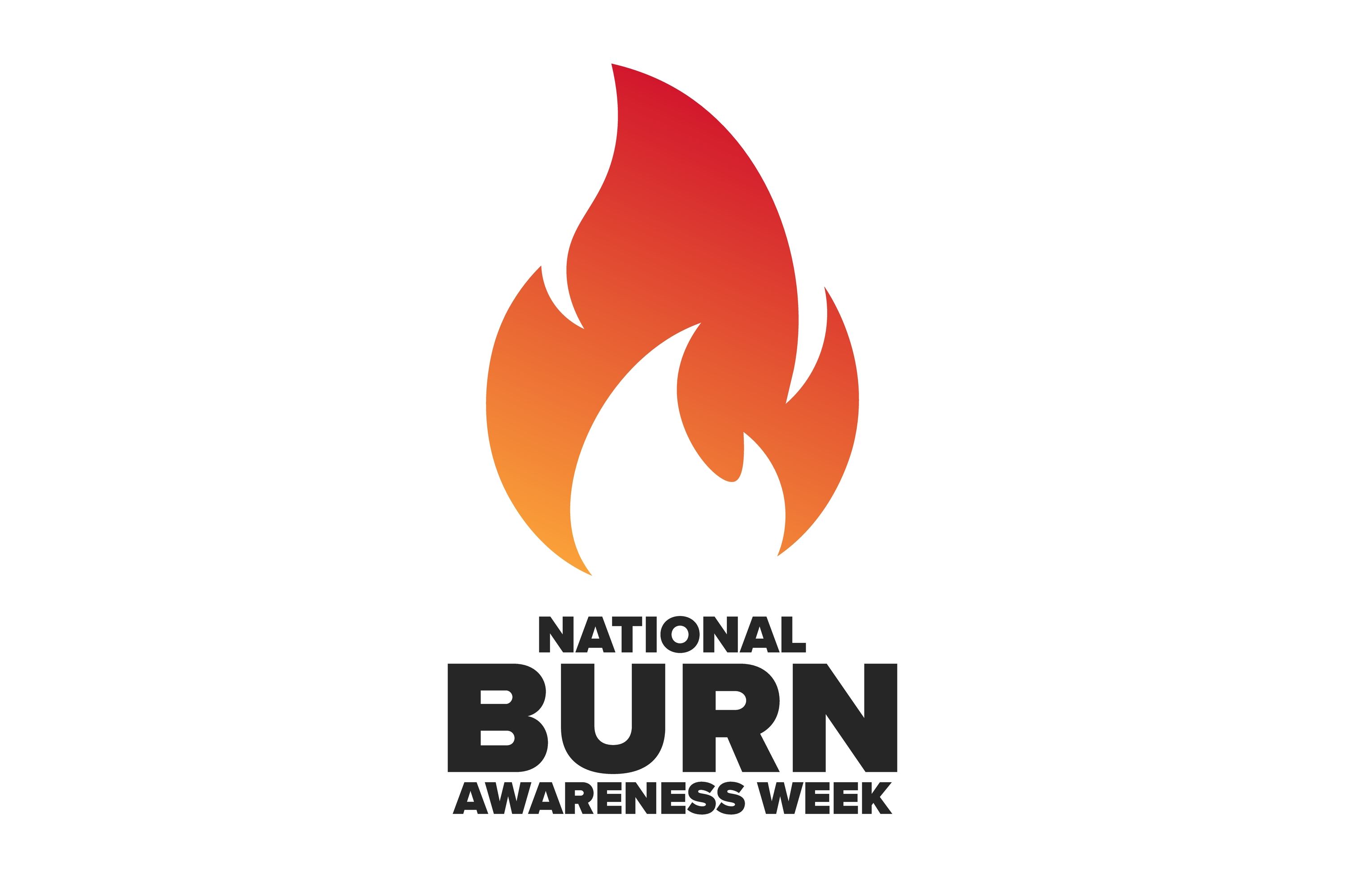 National Burn Awareness Week 2021: How to Treat an Electrical Burn